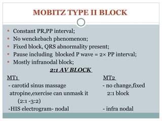 ECG - AV Block | PPT