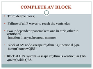 ECG - AV Block | PPT