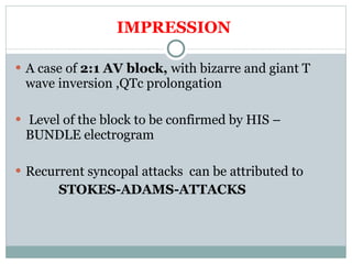 ECG - AV Block | PPT
