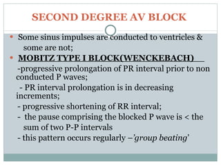 ECG - AV Block | PPT