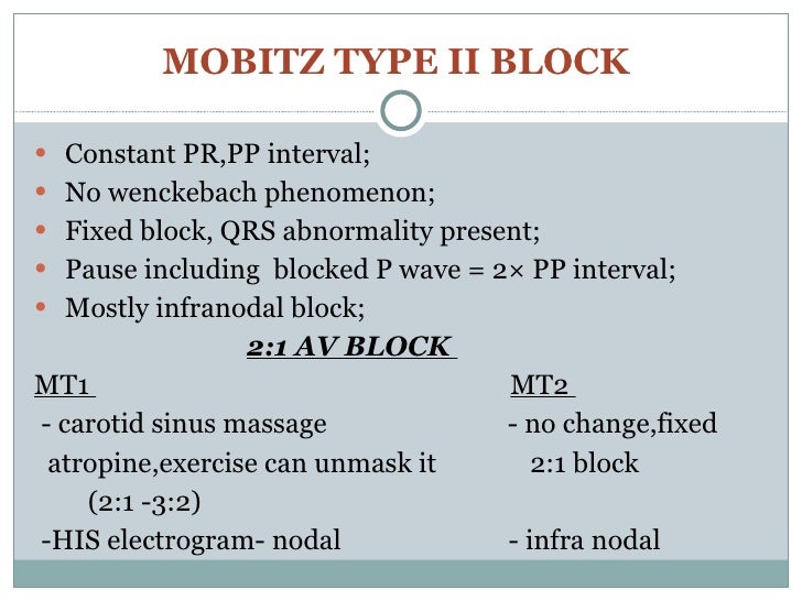 ECG - AV Block