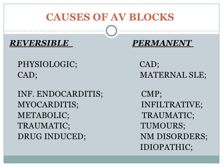 ECG - AV Block