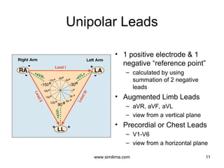 ecg-the-basics.ppt cardiovascular disorder | PPT
