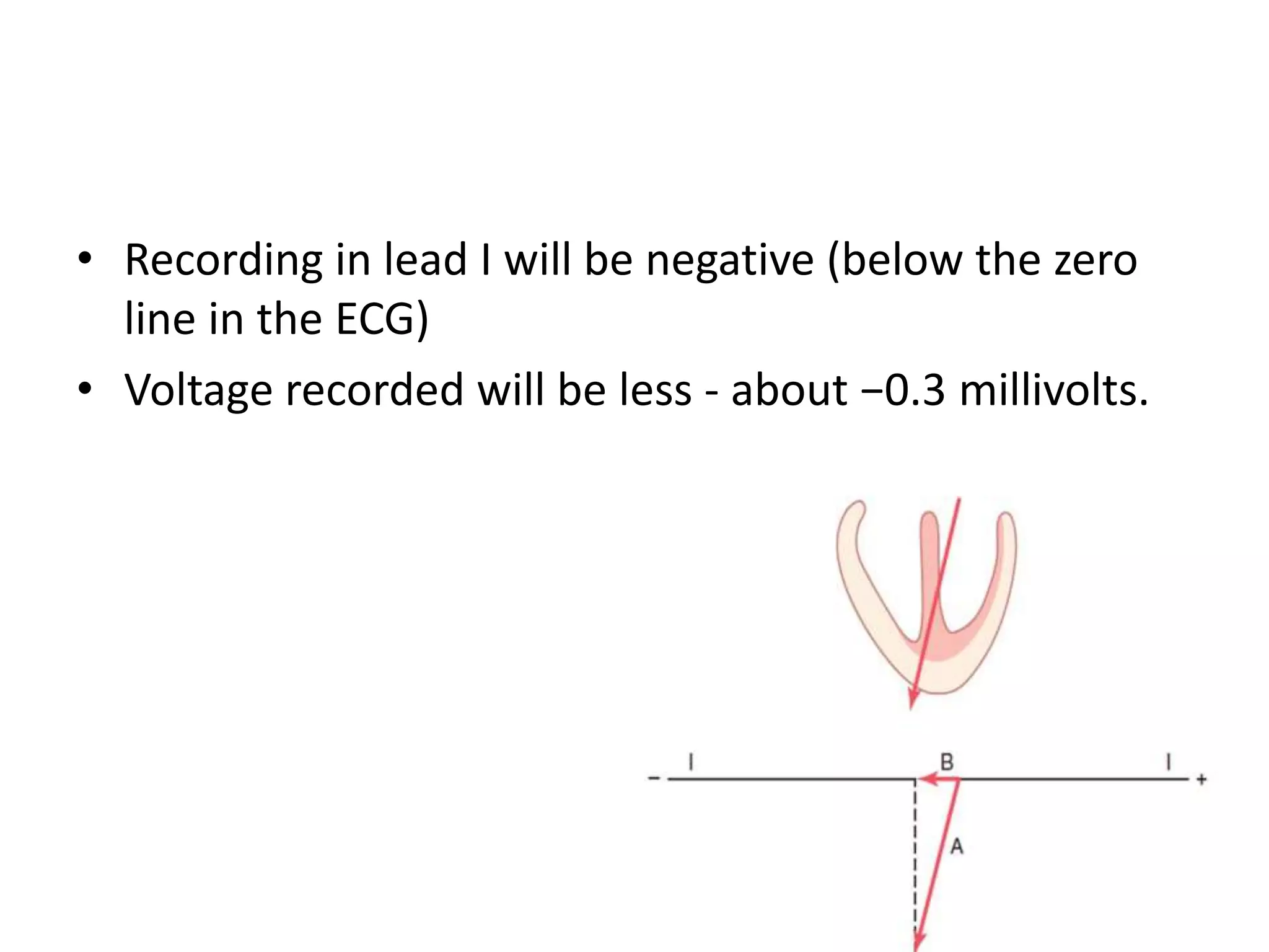 Ecg- Vector Analysis | PPTX