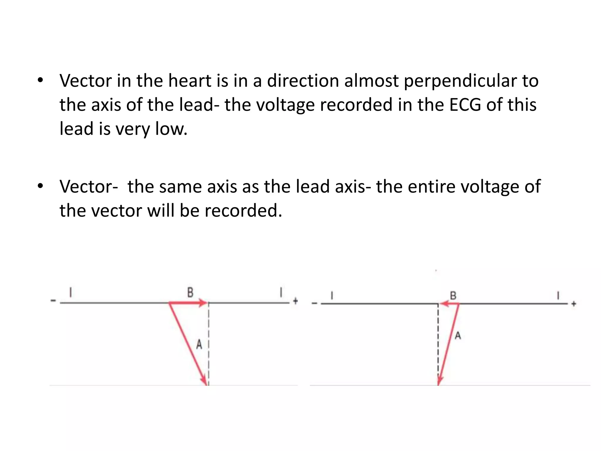Ecg- Vector Analysis | PPTX