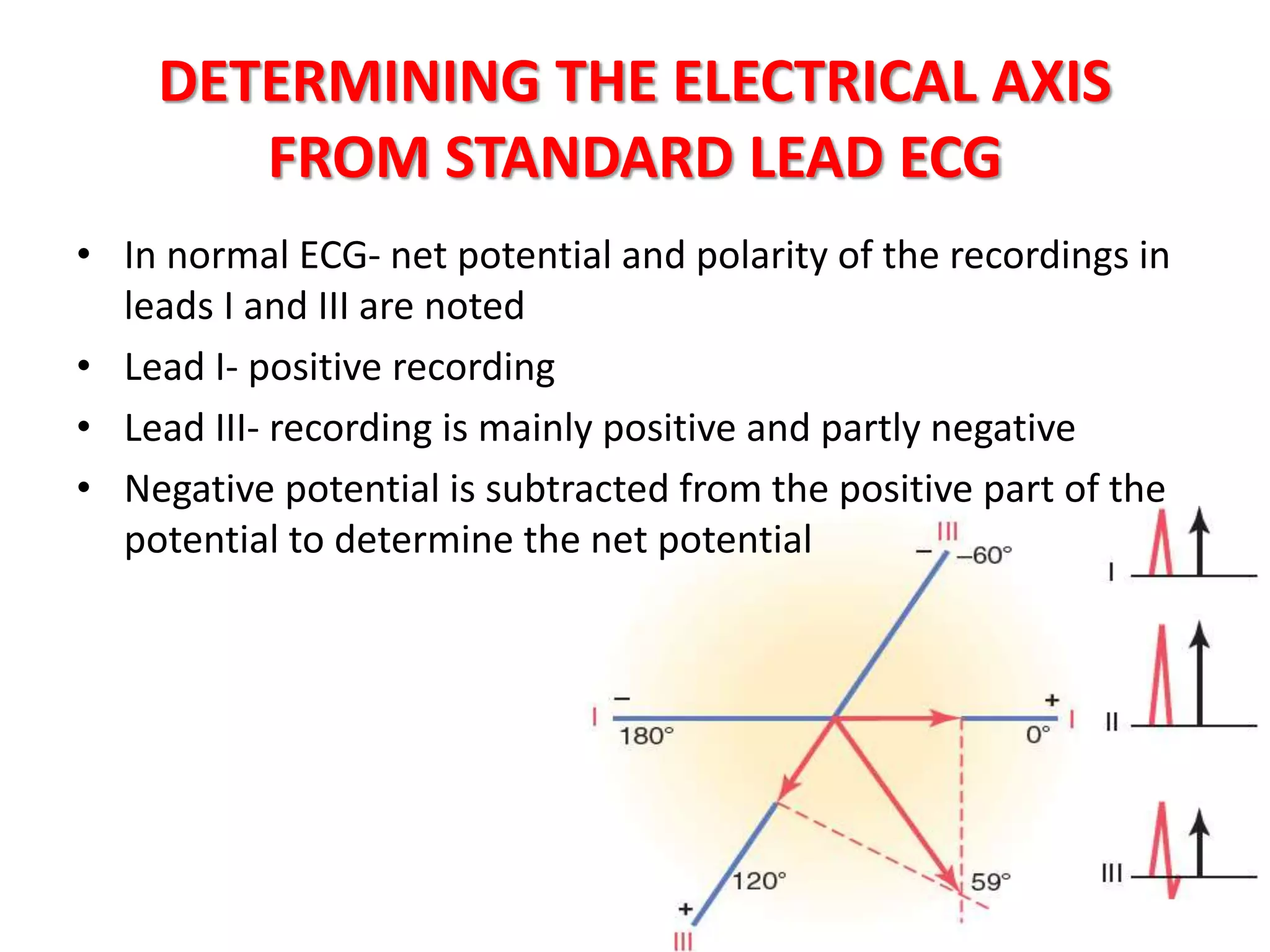 Ecg- Vector Analysis | PPTX