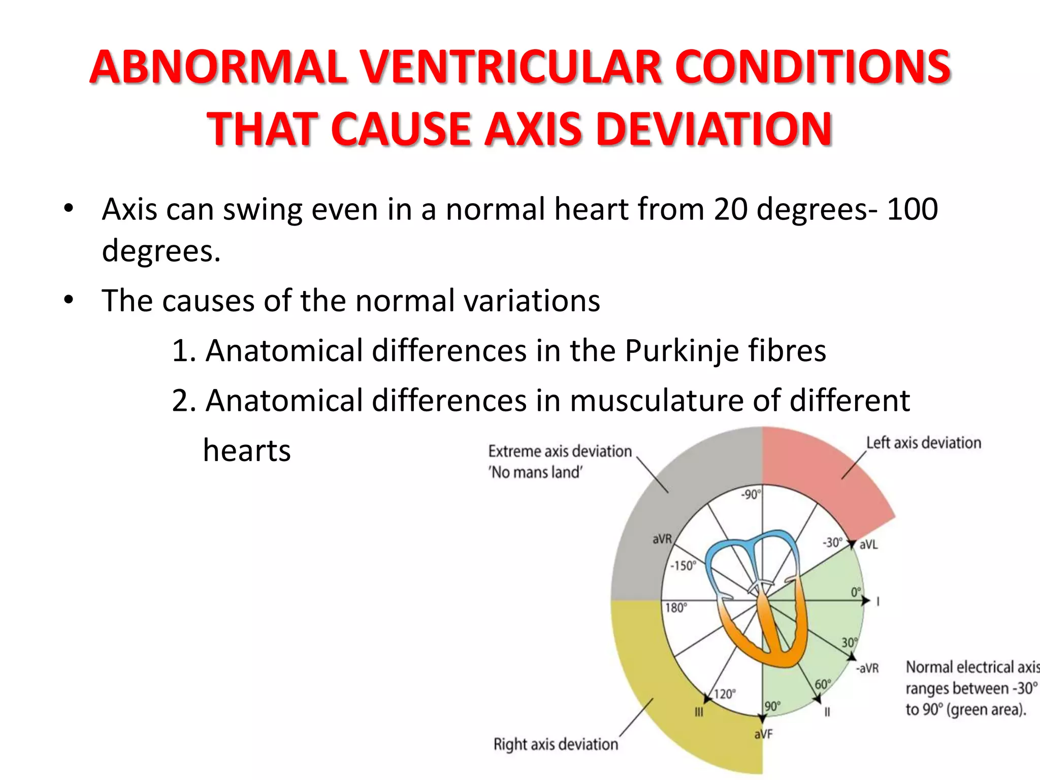 Ecg- Vector Analysis | PPTX