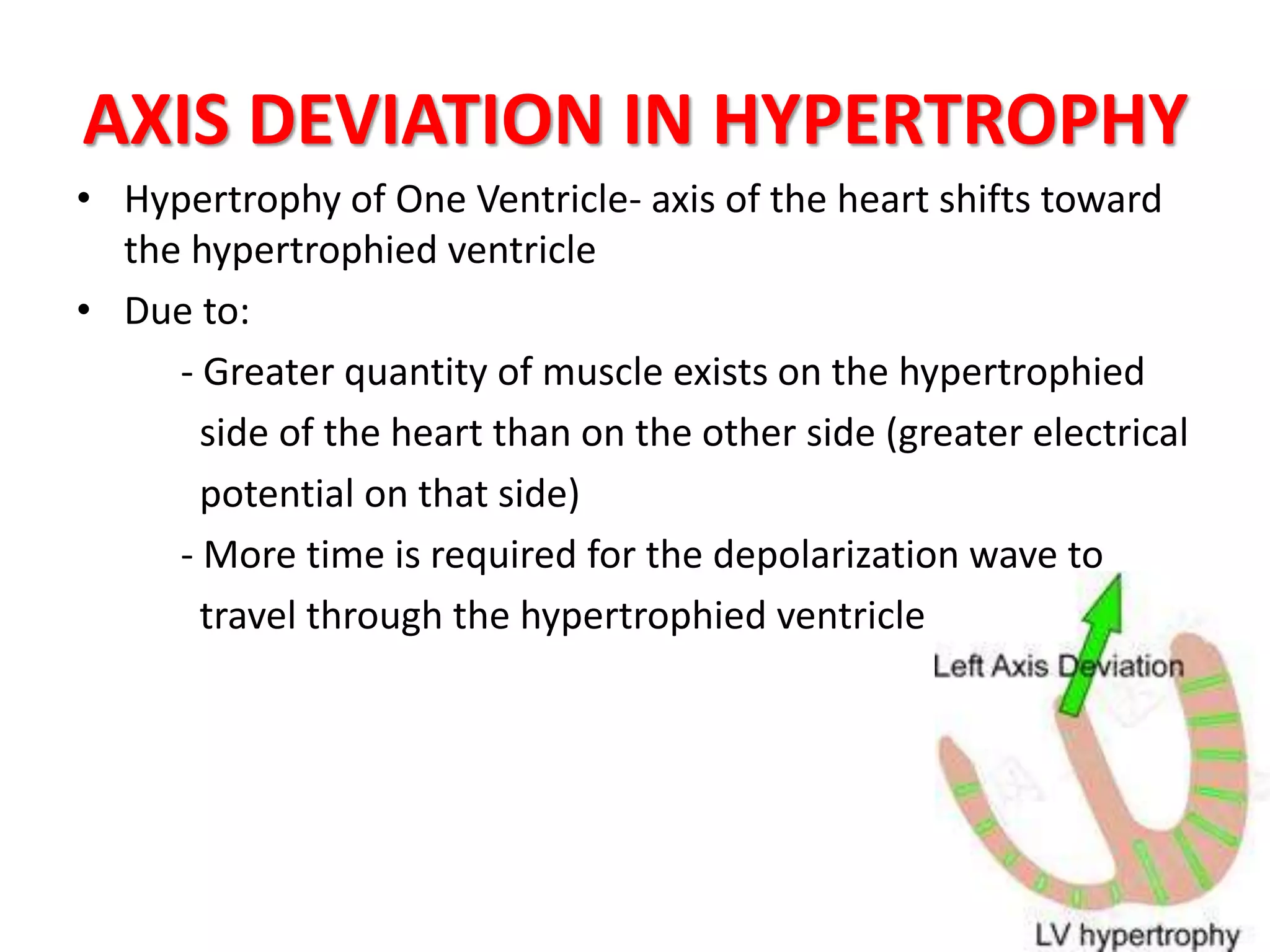 Ecg- Vector Analysis | PPTX