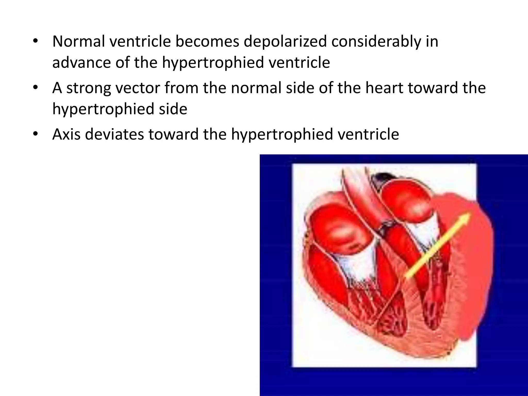 Ecg- Vector Analysis | PPTX