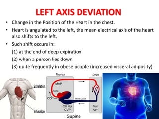 Ecg- Vector Analysis | PPTX