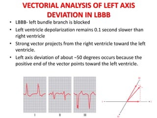 Ecg- Vector Analysis | PPTX
