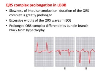 Ecg- Vector Analysis | PPTX
