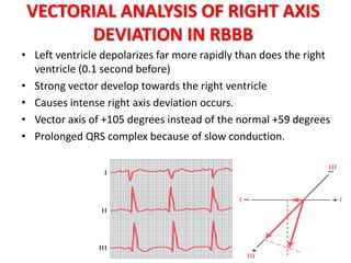 Ecg- Vector Analysis | PPTX
