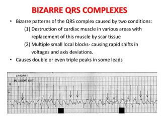 Ecg- Vector Analysis | PPTX