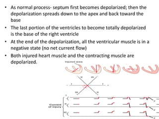 Ecg- Vector Analysis | PPTX