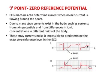 Ecg- Vector Analysis | PPTX