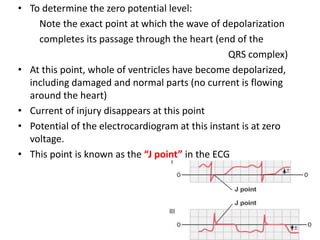 Ecg- Vector Analysis | PPTX