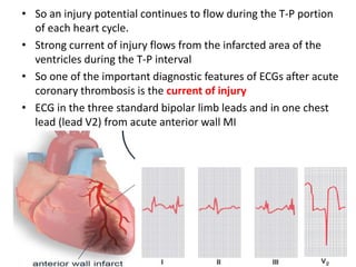 Ecg- Vector Analysis | PPTX