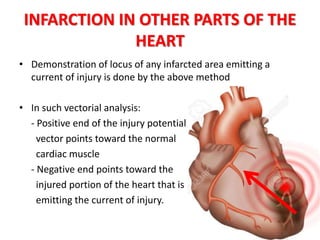 Ecg- Vector Analysis | PPTX