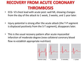 Ecg- Vector Analysis | PPTX