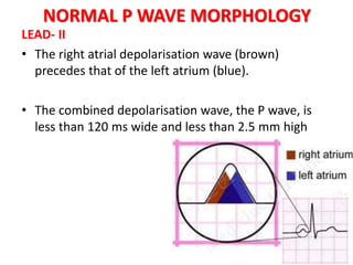 Ecg- Vector Analysis | PPTX