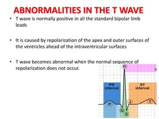 Ecg- Vector Analysis | PPTX