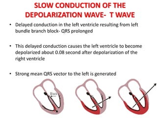 Ecg- Vector Analysis | PPTX