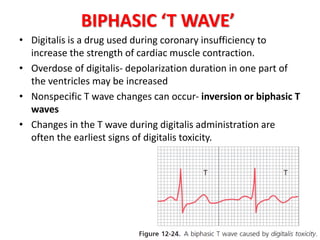 Ecg- Vector Analysis | PPTX