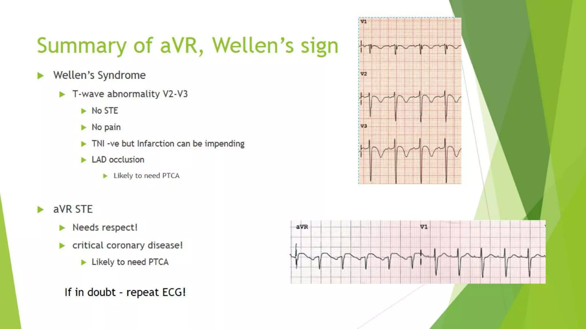 ECG Wellen's sign and Widow maker sign presentation | PPTX