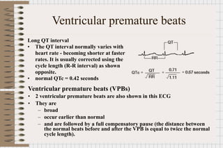 ECG workbook | PDF | Heart and Cardiovascular Diseases | Diseases and ...