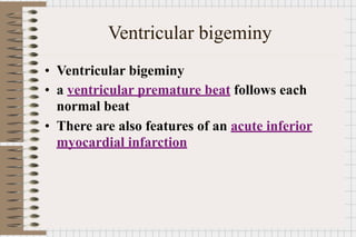 ECG workbook | PDF | Heart and Cardiovascular Diseases | Diseases and ...