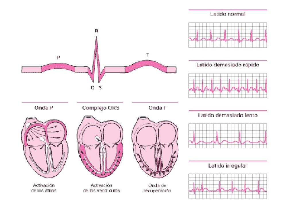 ECG básico
