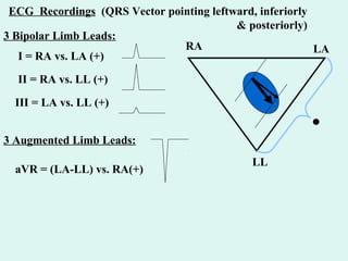 Ecg 1 | PPT