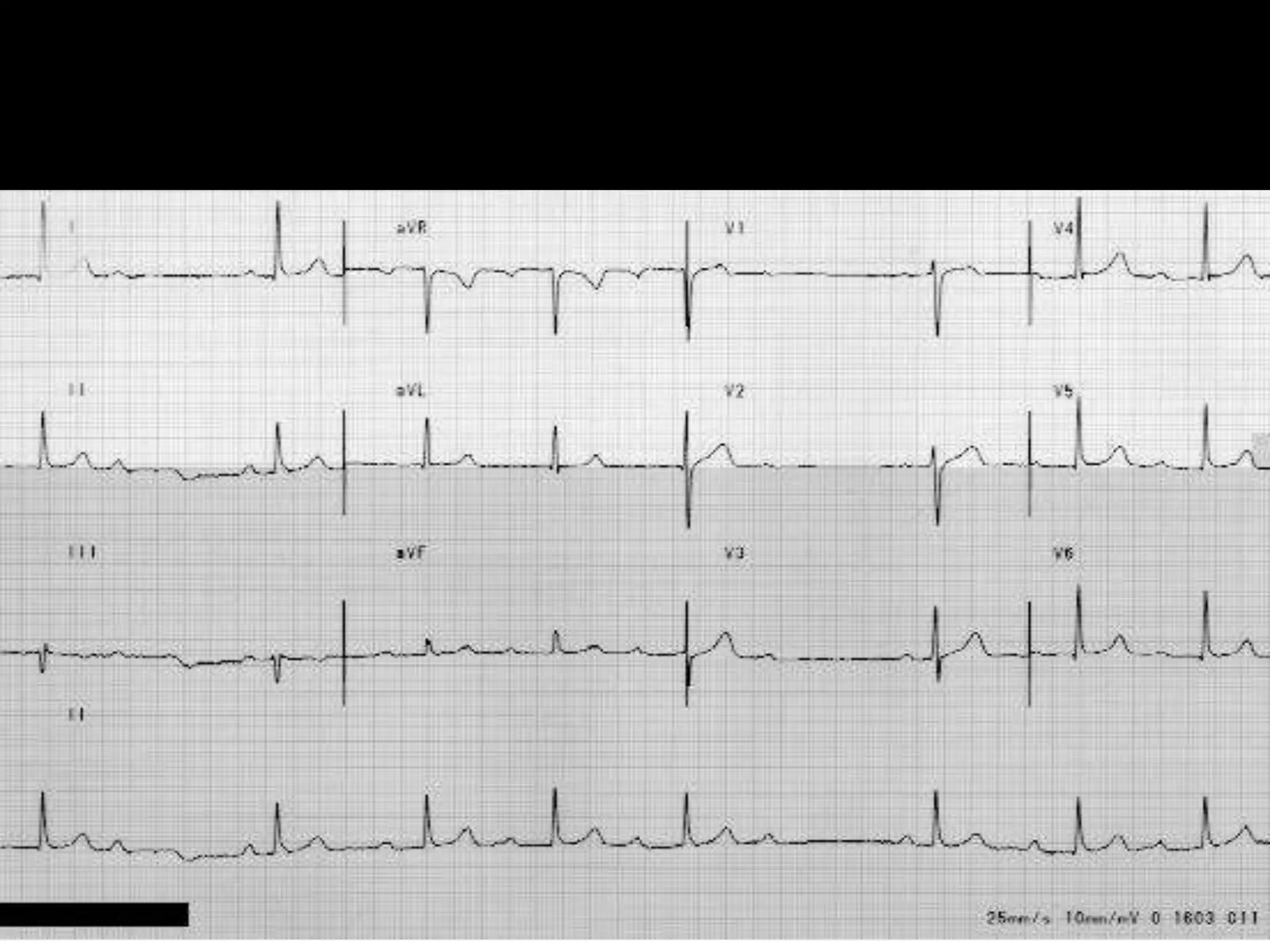 Electrocardiography | PPTX