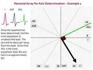 Electrocardiography | PPTX