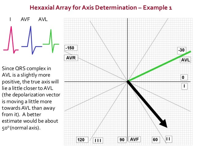 Electrocardiography