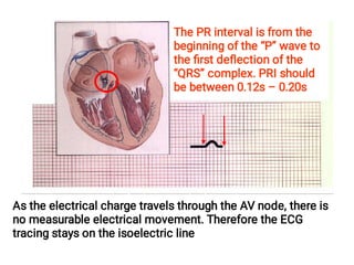 ECG1.pdf | Heart and Cardiovascular Diseases | Diseases and Conditions