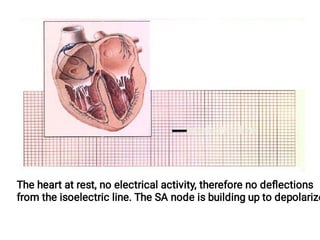 ECG1.pdf | Heart and Cardiovascular Diseases | Diseases and Conditions