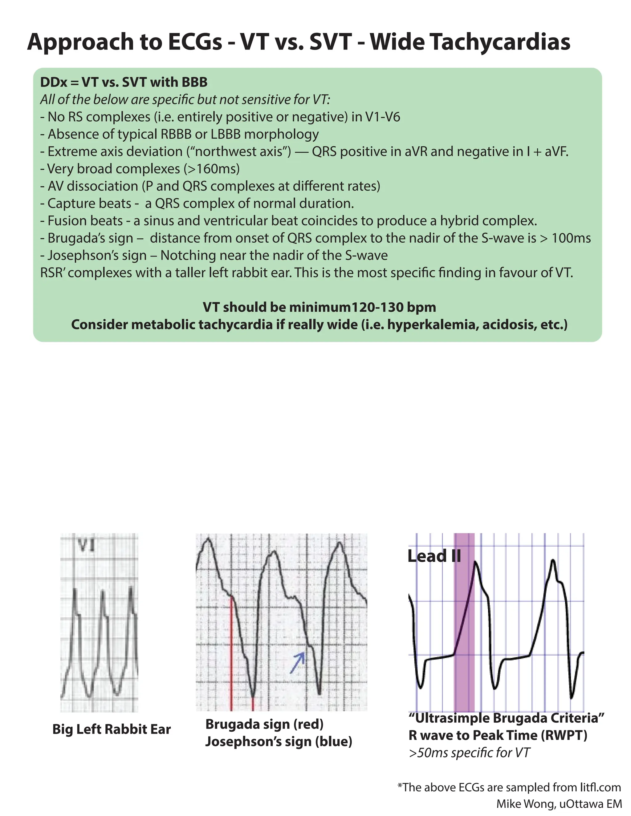 ECG (1).pdf LECTURA RAPIDA DE EKG BASICO. IDIOMA INGLES. CONCISO Y MUY ...