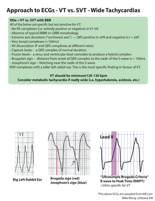 ECG (1).pdf LECTURA RAPIDA DE EKG BASICO. IDIOMA INGLES. CONCISO Y MUY ...