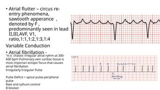 ECG[1]bjkjgfjkkjhfffffgjhgfujuhghjjg.pptx