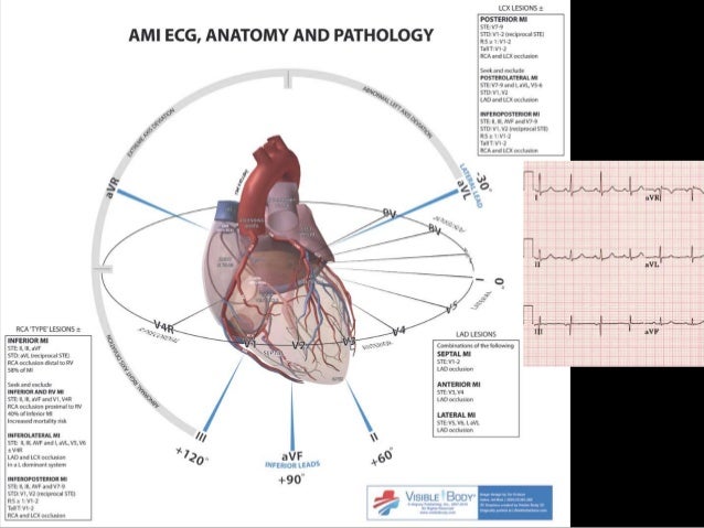 ECG 101