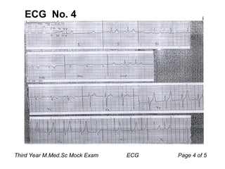 ECG 10 with Answer Keys (23.9.2005).ppt
