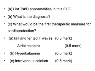 ECG 10 with Answer Keys (23.9.2005).ppt