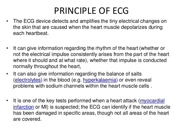 Ecg123 (1)