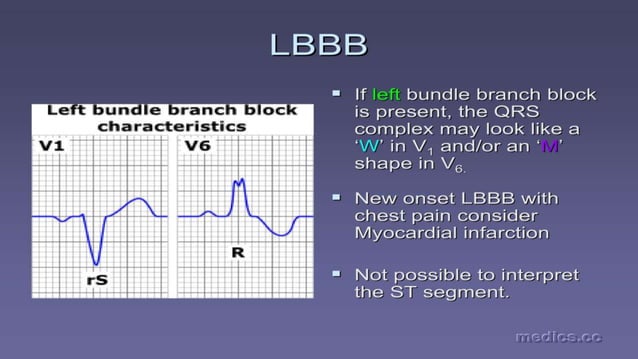 Ecg & 12 lead ecg | PPT