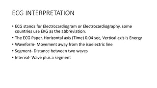 Ecg & 12 lead ecg | PPTX