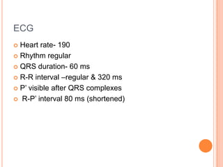 ECG: Reciprocating tachycardia | PPTX
