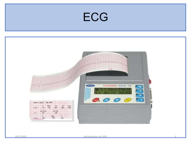ECG 1 procedure ECG.pptx