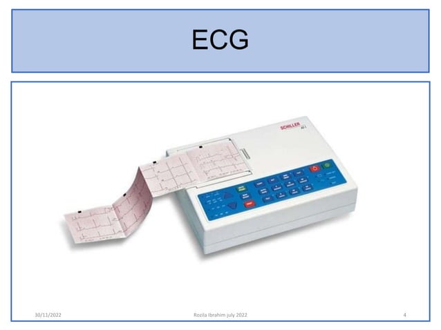 ECG 1 procedure ECG.pptx
